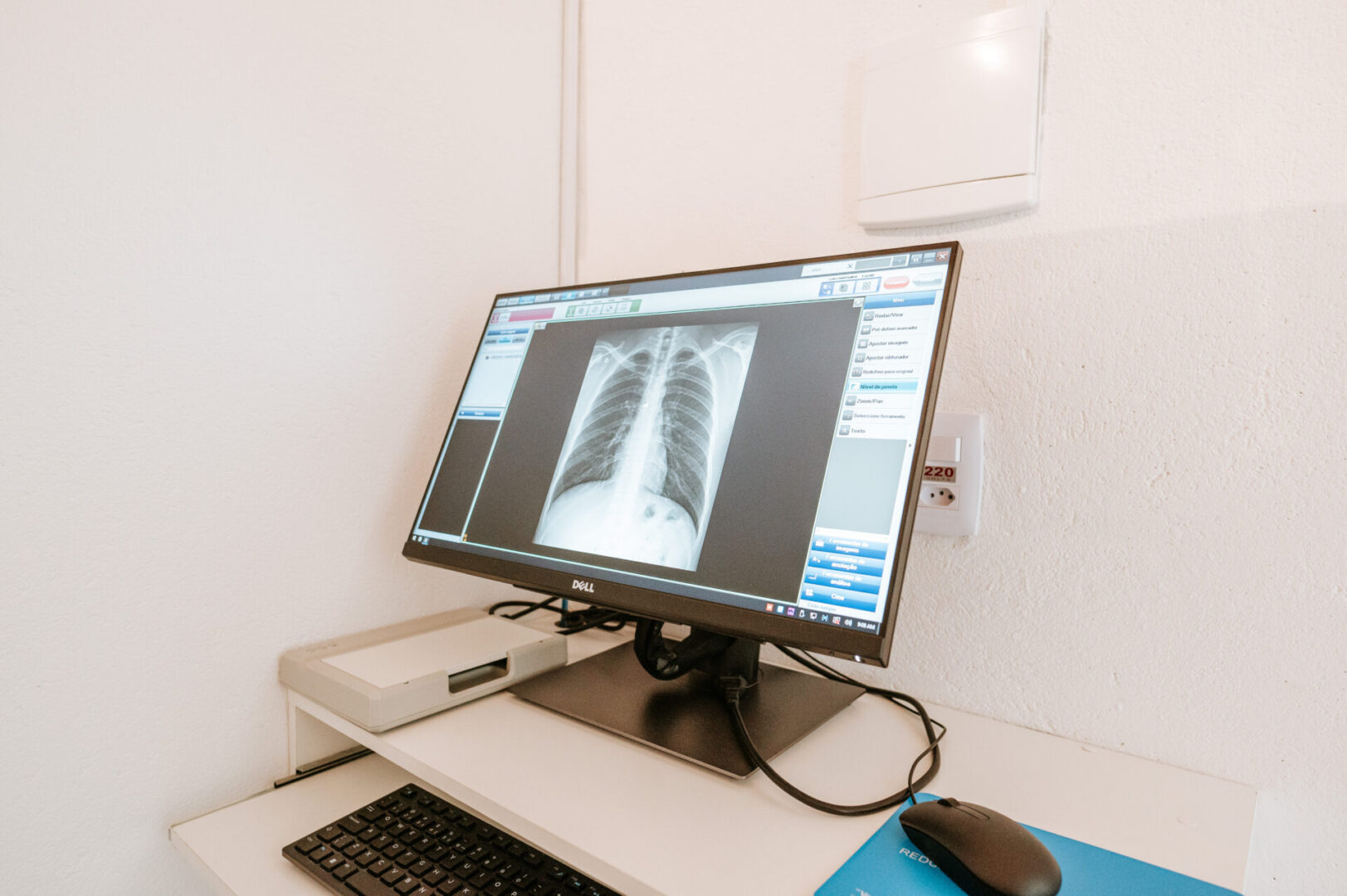 Descubra o que é o raio-x tórax OIT e para que ele serve - OpusMed