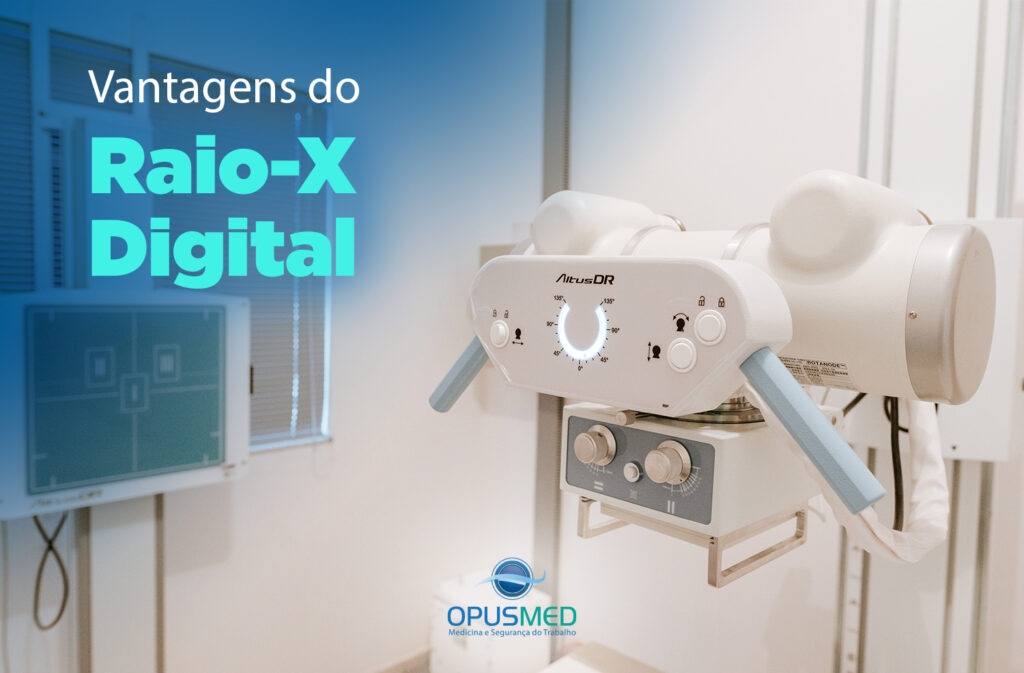 Conheça as Vantagens do Raio-X Digital - OpusMed